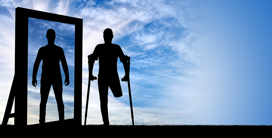 Projet novateur pour les personnes amputées: l'arrivée de l ...